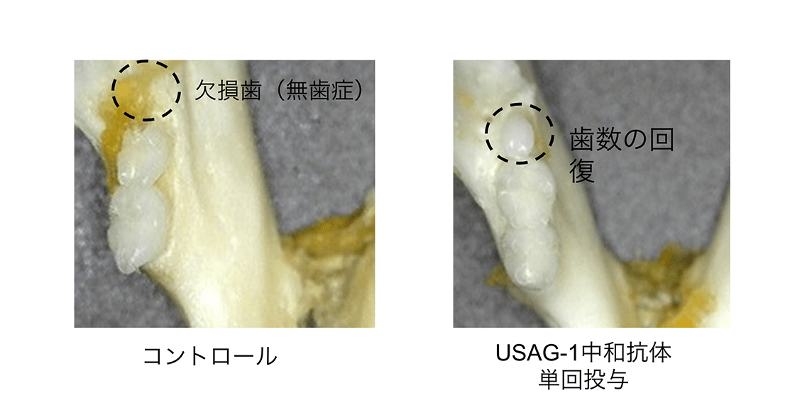 Japanese Pioneer Drug to Regrow Teeth